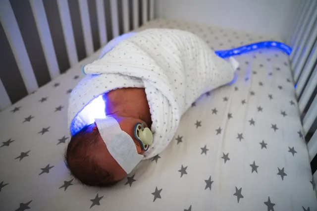 How To Use GE BiliSoft Phototherapy Blanket | Vegas Bili Blankets